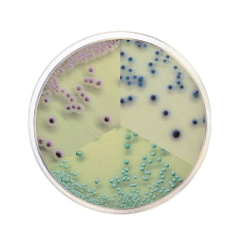 Candida Chromogenic Agar – BICS